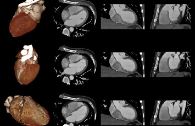 CT Registry Review | MTMI